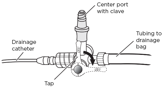 About Your Biliary Drainage Catheter | Memorial Sloan Kettering Cancer ...